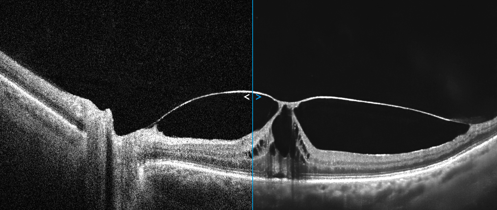 OCT Optopol Revo HR – 3B Optic Instruments