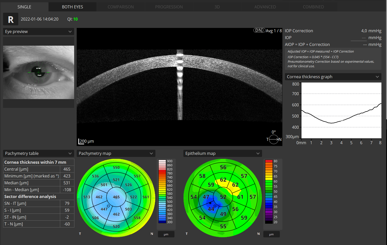 OCT Optopol Revo FC130 – 3B Optic Instruments