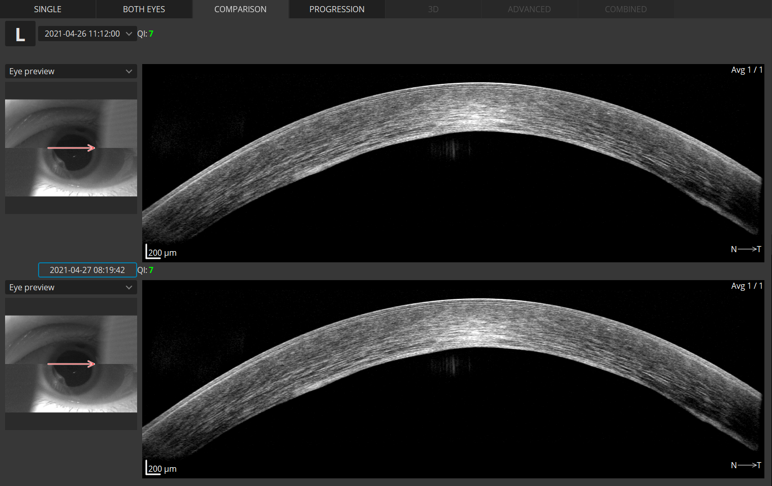 OCT Optopol Revo FC130 – 3B Optic Instruments