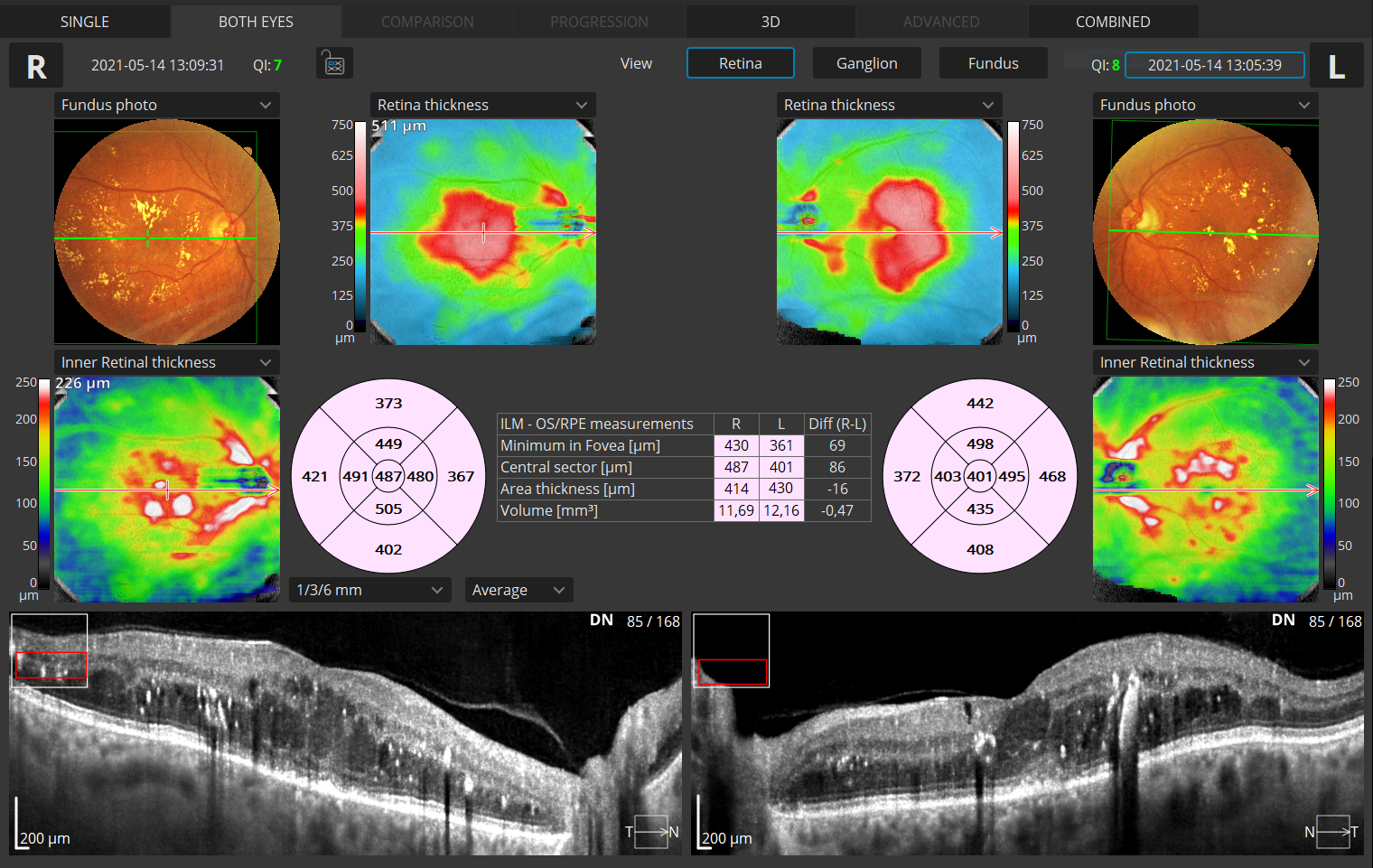 OCT Optopol Revo FC130 – 3B Optic Instruments