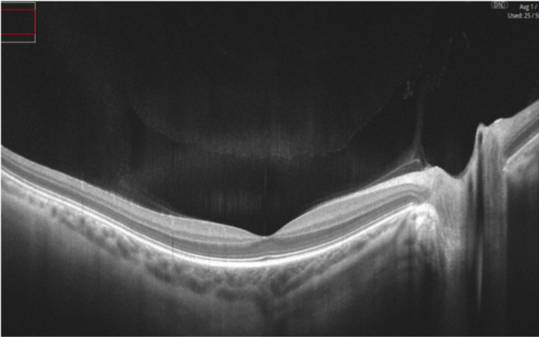 OCT Optopol Revo 60 – 3B Optic Instruments