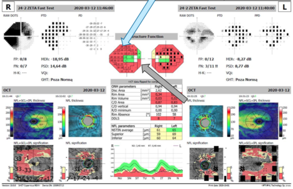 OCT Optopol Revo 60 – 3B Optic Instruments