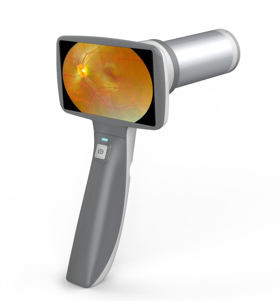 Cámaras Retinales – 3B Optic Instruments