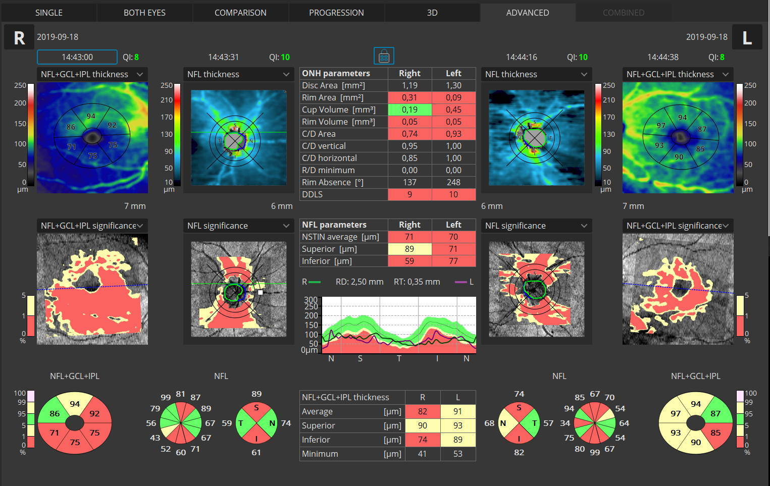 OCT Optopol Revo FC130 – 3B Optic Instruments