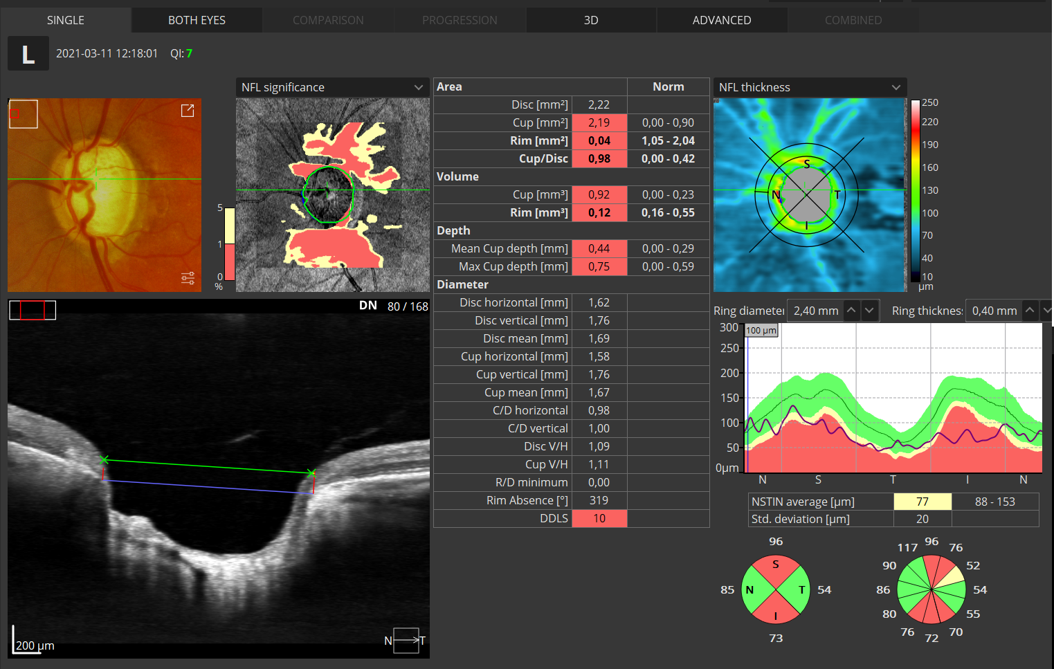 OCT Optopol Revo FC130 – 3B Optic Instruments