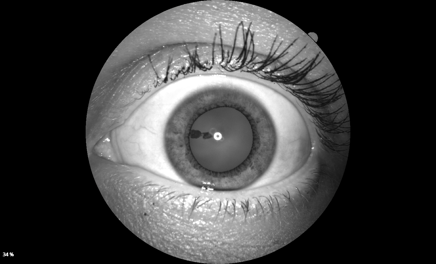 OCT Optopol Revo FC130 – 3B Optic Instruments