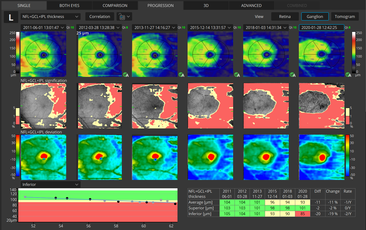 OCT Optopol Revo FC130 – 3B Optic Instruments
