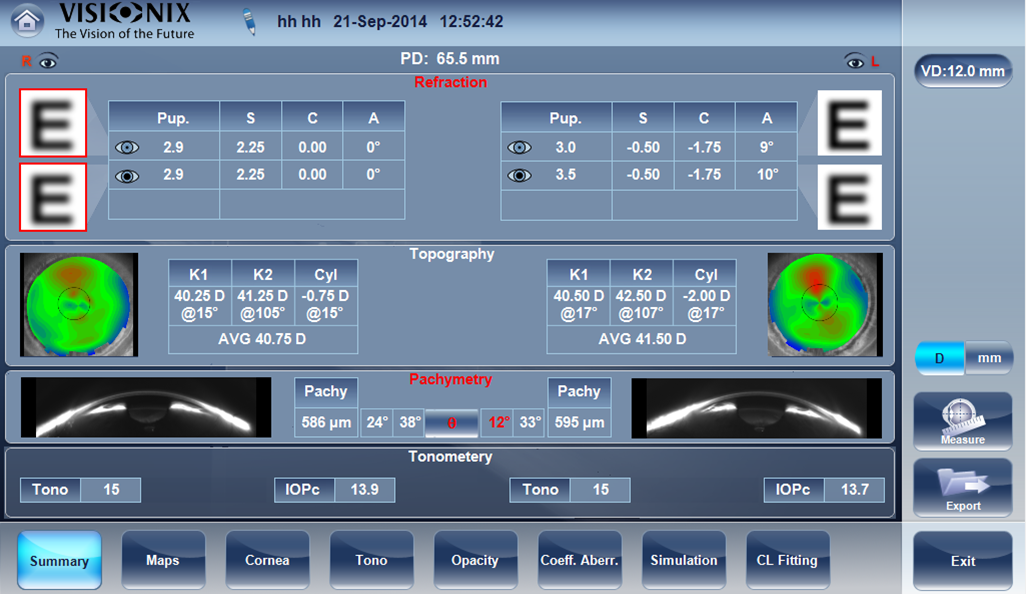 Plataforma Visionix VX-120 + Dry Eye – 3B Optic Instruments