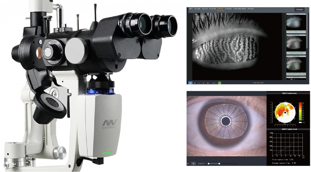 Mediworks S-390L DRY EYE – Sistema Completo para Ojo Seco – 3B Optic ...